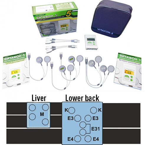 Vitafon-5 (extended configuration) and Vibroacoustic corset | Inspire ...