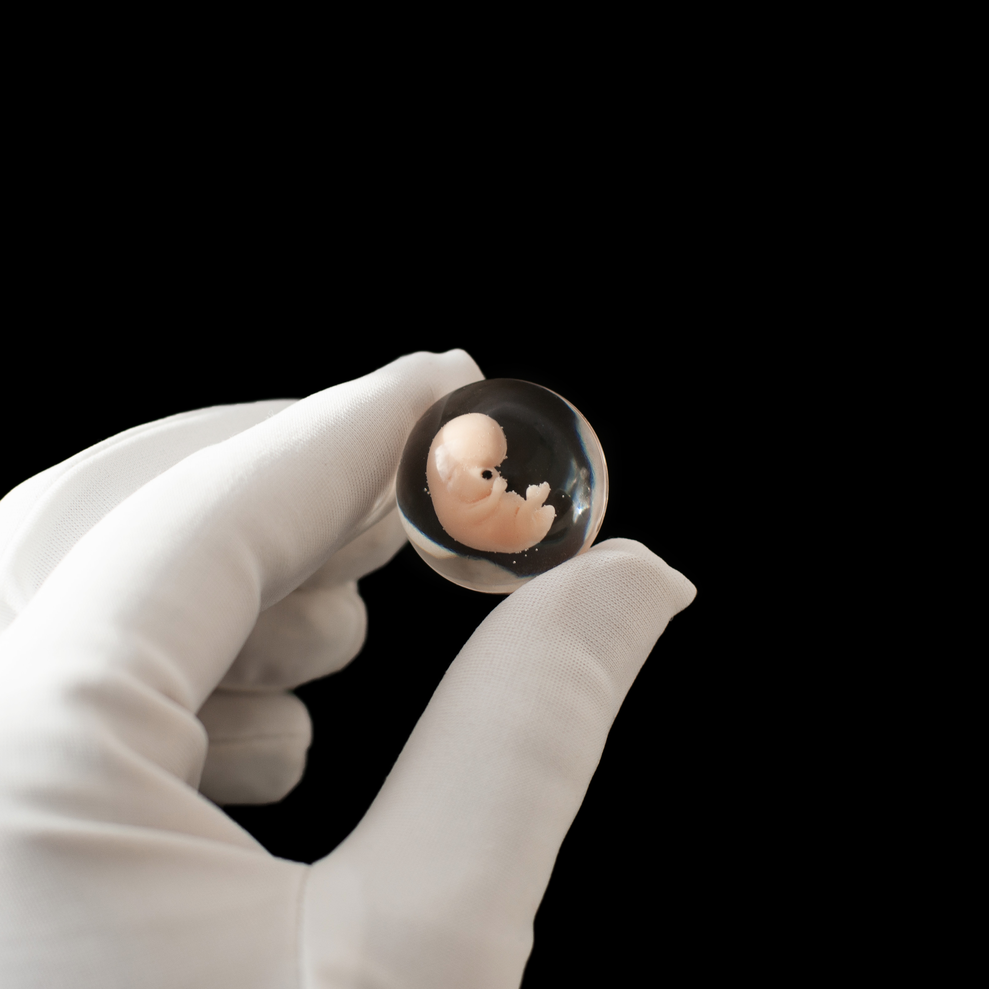 Embryo 7 weeks in Lens, 7 weeks pregnant, Sculpture cast in - Inspire ...