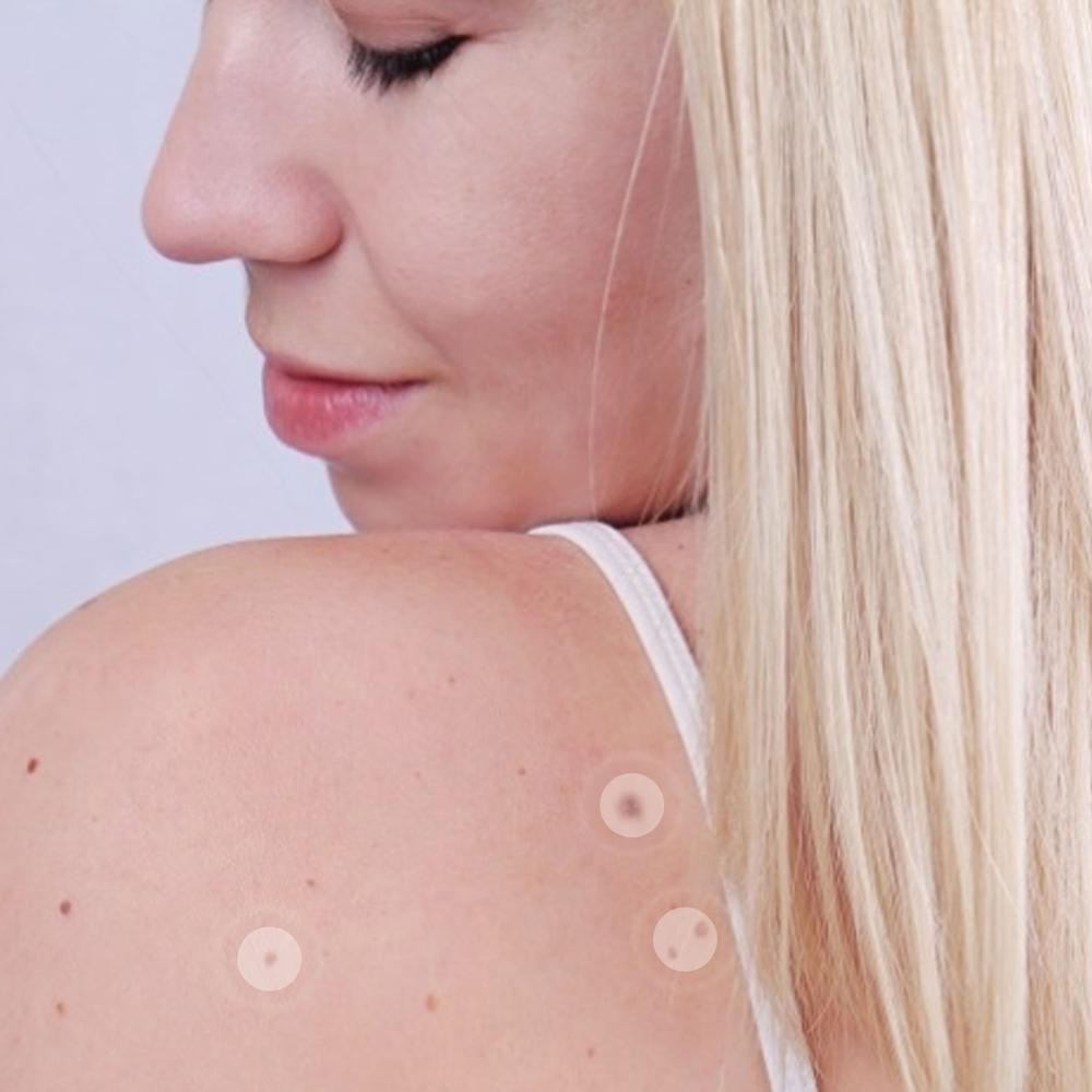 Natural Anti-Skin Tag Patches | Inspire Uplift