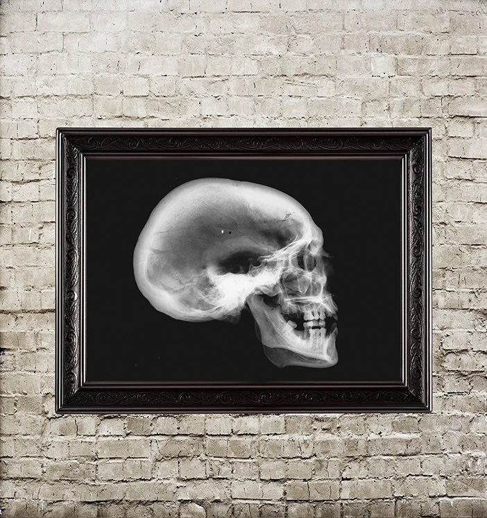 X-ray of a human skull. 572. - Inspire Uplift