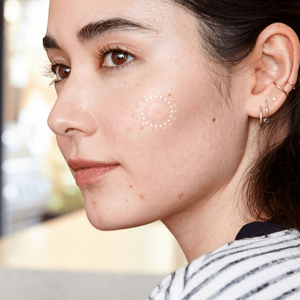 Auto Skin Tag Remover Kit | Inspire Uplift