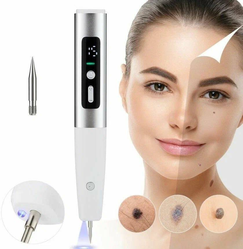 Laser pen for removing moles, freckles, black dots, warts, p | Inspire ...