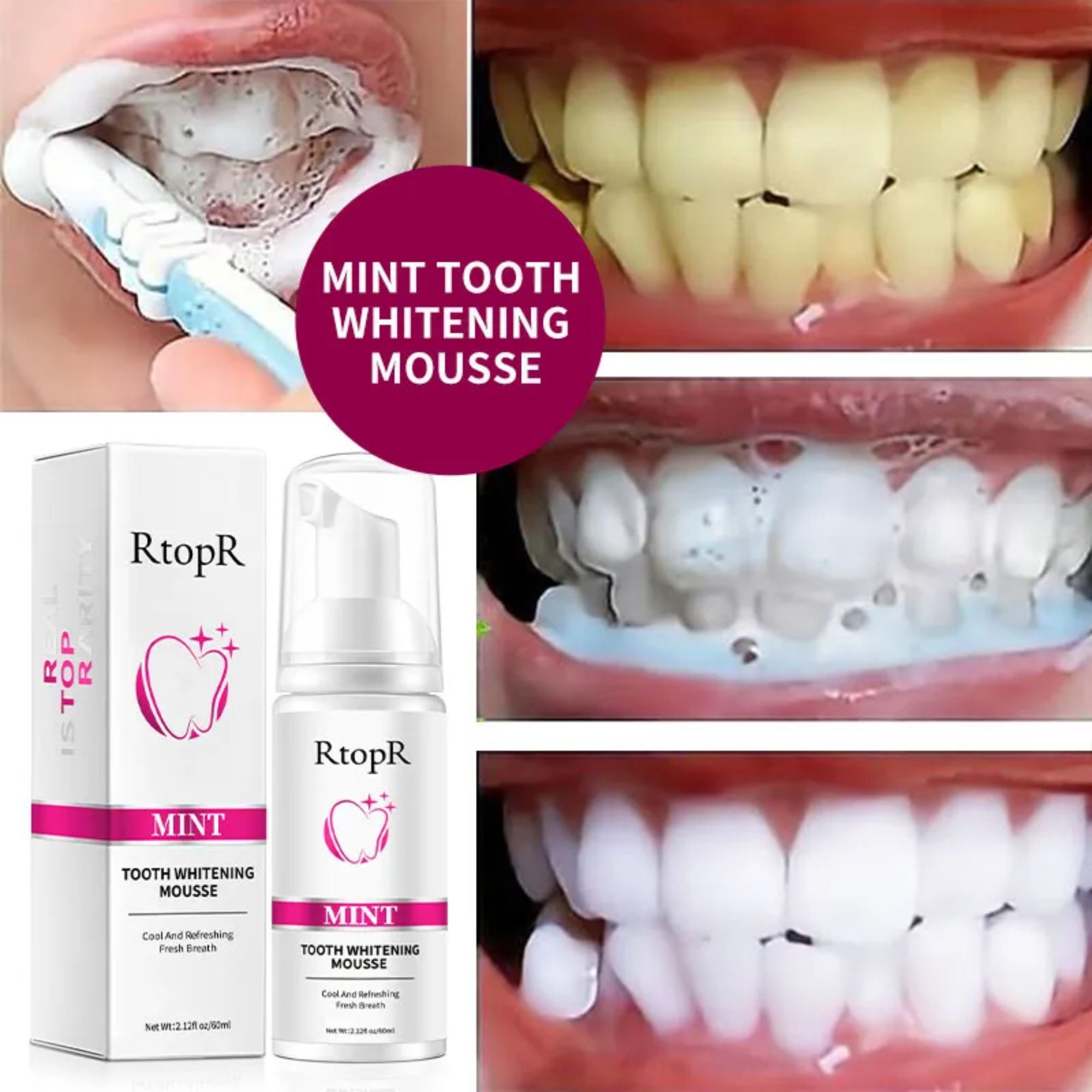Teeth Cleansing Whitening Mousse Whitening Teeth Remove toot | Inspire ...