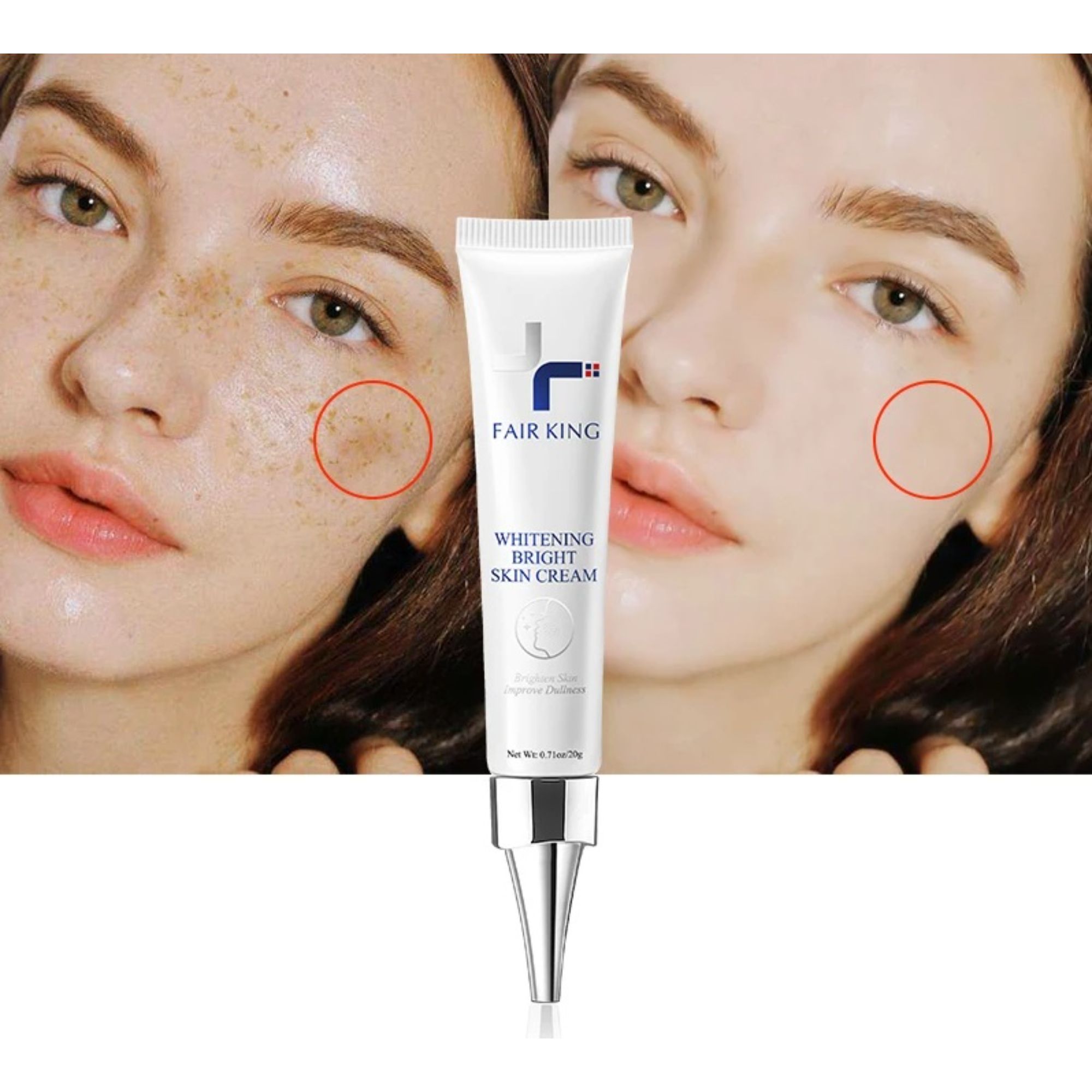 Spot Cream Remove Chloasma Eliminate Dark Spots Brighten Ski | Inspire ...