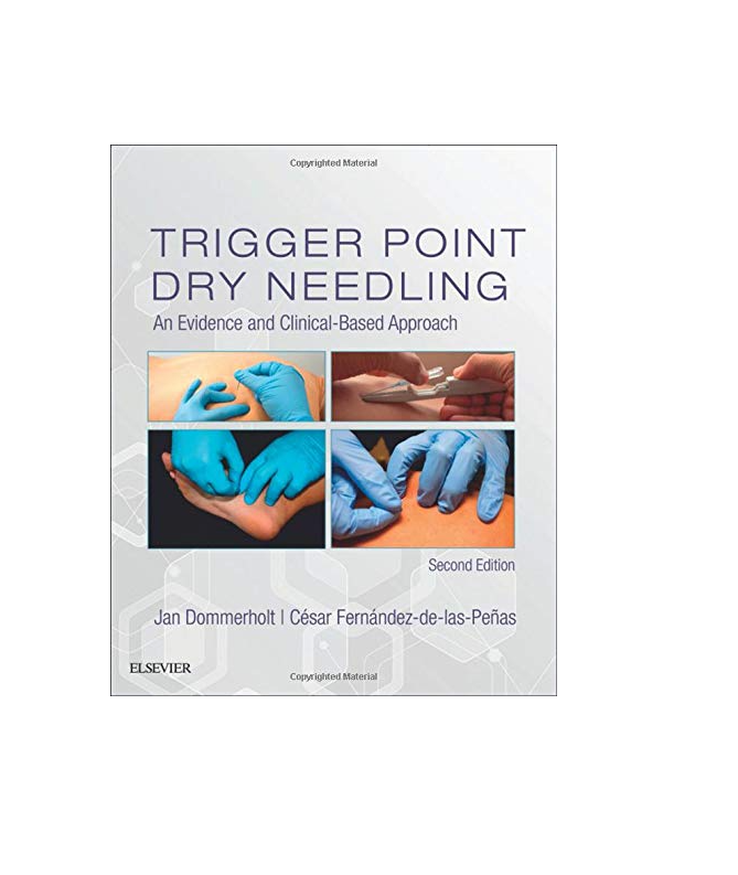 Trigger Point Dry Needling: An Evidence and Clinical-Based A - Inspire ...