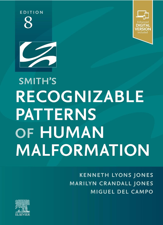 Smith's Recognizable Patterns of Human Malformation - E-Book | Inspire ...