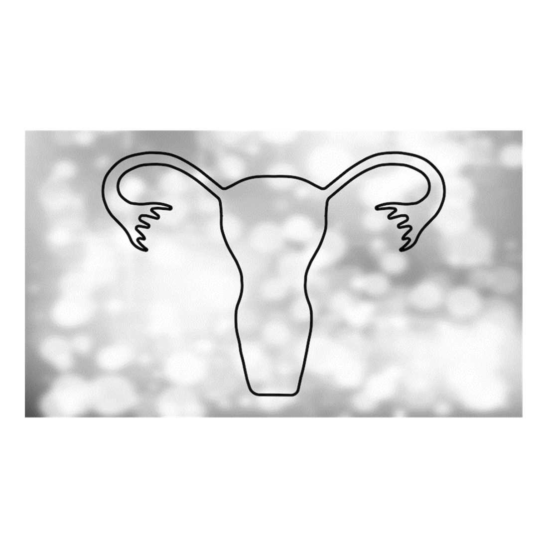 Medical Clipart: Basic Black Outline of Human Uterus Reprodu | Inspire ...