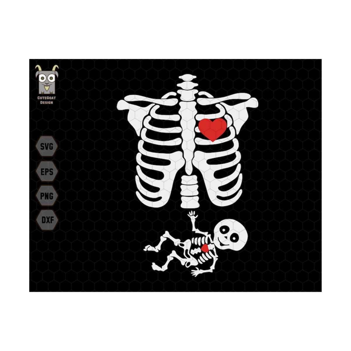 Product | Inspire Uplift