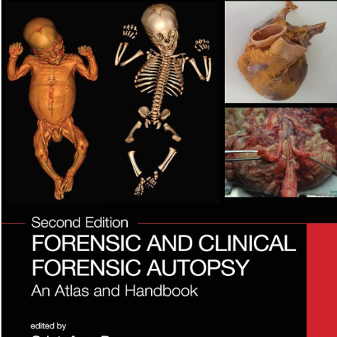 Forensic and Clinical Forensic Autopsy. An Atlas and Handboo | Inspire ...