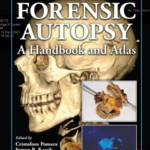 Forensic Autopsy. A Handbook and Atlas | Inspire Uplift