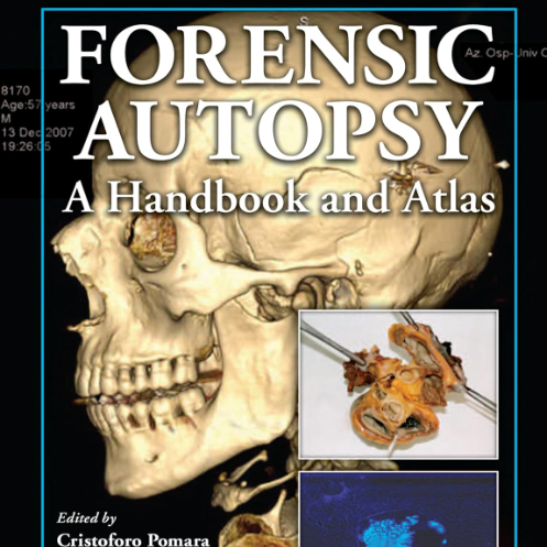 Forensic Autopsy. A Handbook and Atlas | Inspire Uplift