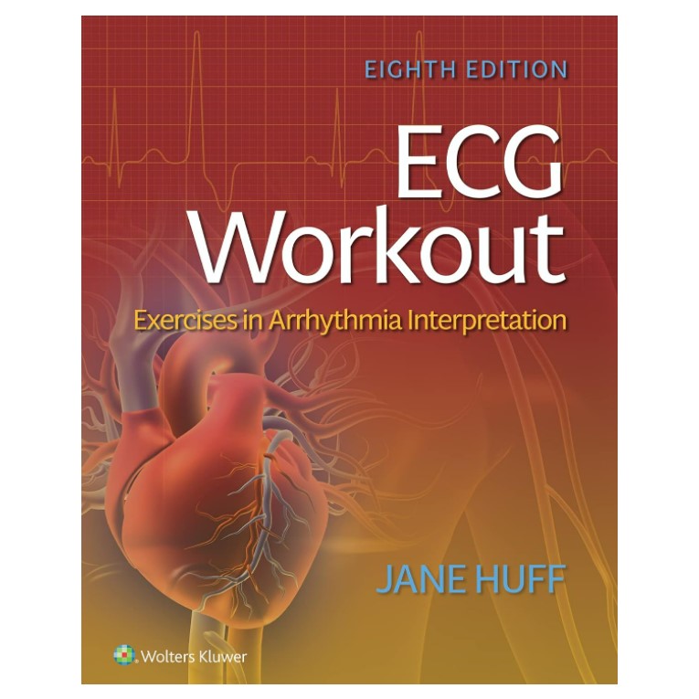 ECG Workout: Exercises in Arrhythmia Interpretation | Inspire Uplift