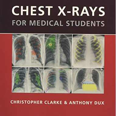 Chest X-rays for Medical Students 1st Edition | Inspire Uplift