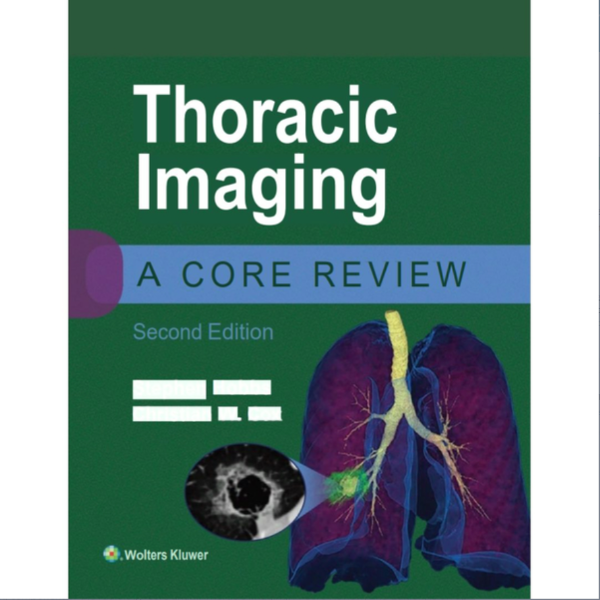 Thoracic Imaging A Core Review 2nd Edition | Inspire Uplift