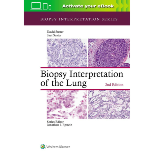 Biopsy Interpretation of the Lung 2nd Edition | Inspire Uplift