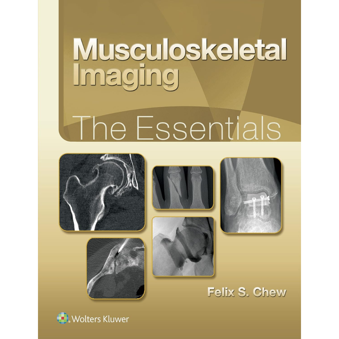 Musculoskeletal Imaging: The Essentials First Edition | Inspire Uplift