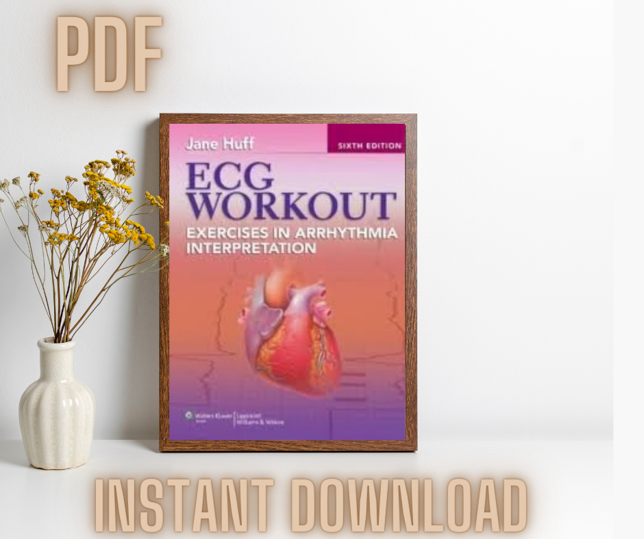 Jane Huff ECG Workout Exercises in Arrhythmia Interpretation | Inspire ...