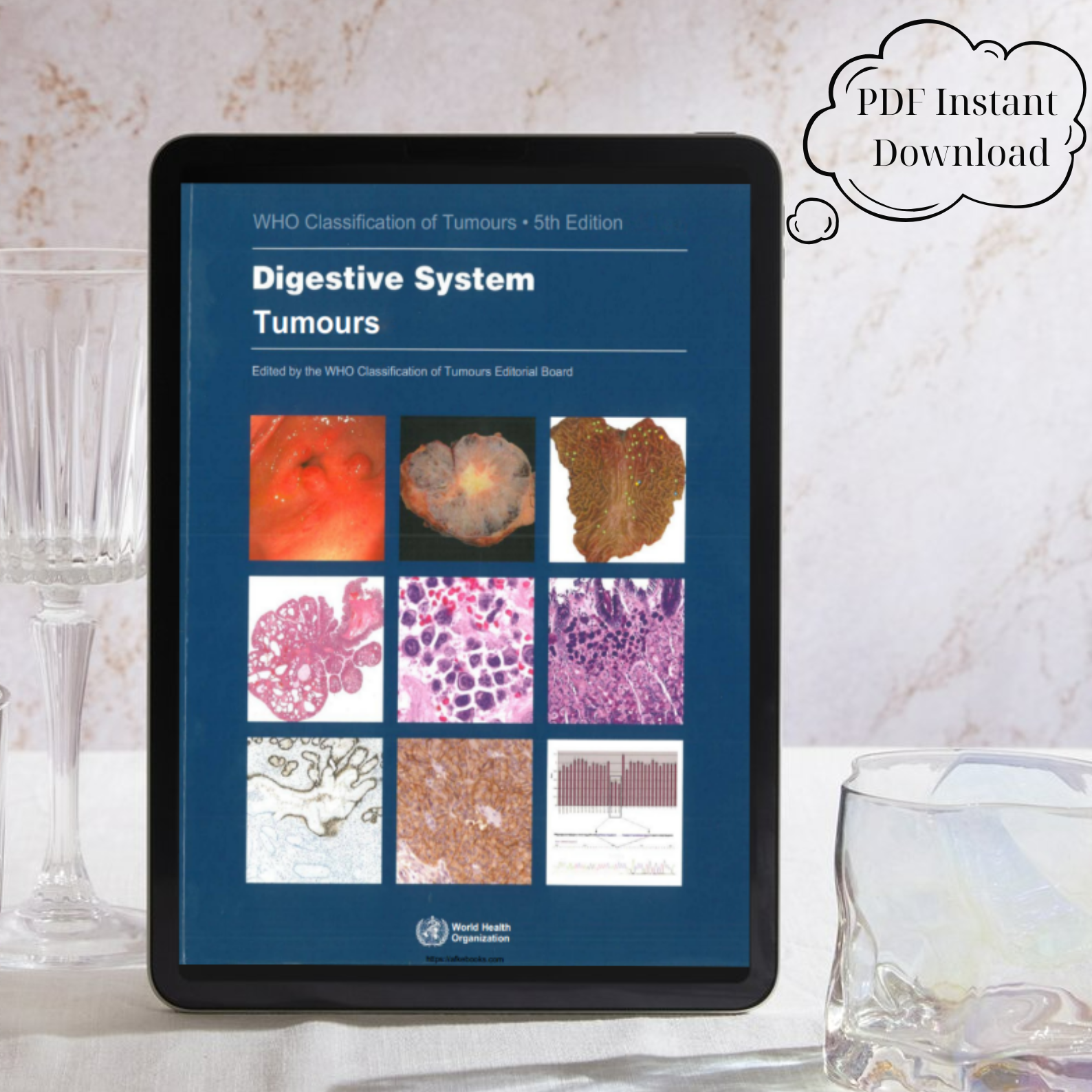 Digestive System Tumours: Who Classification of Tumours, e-b - Inspire ...