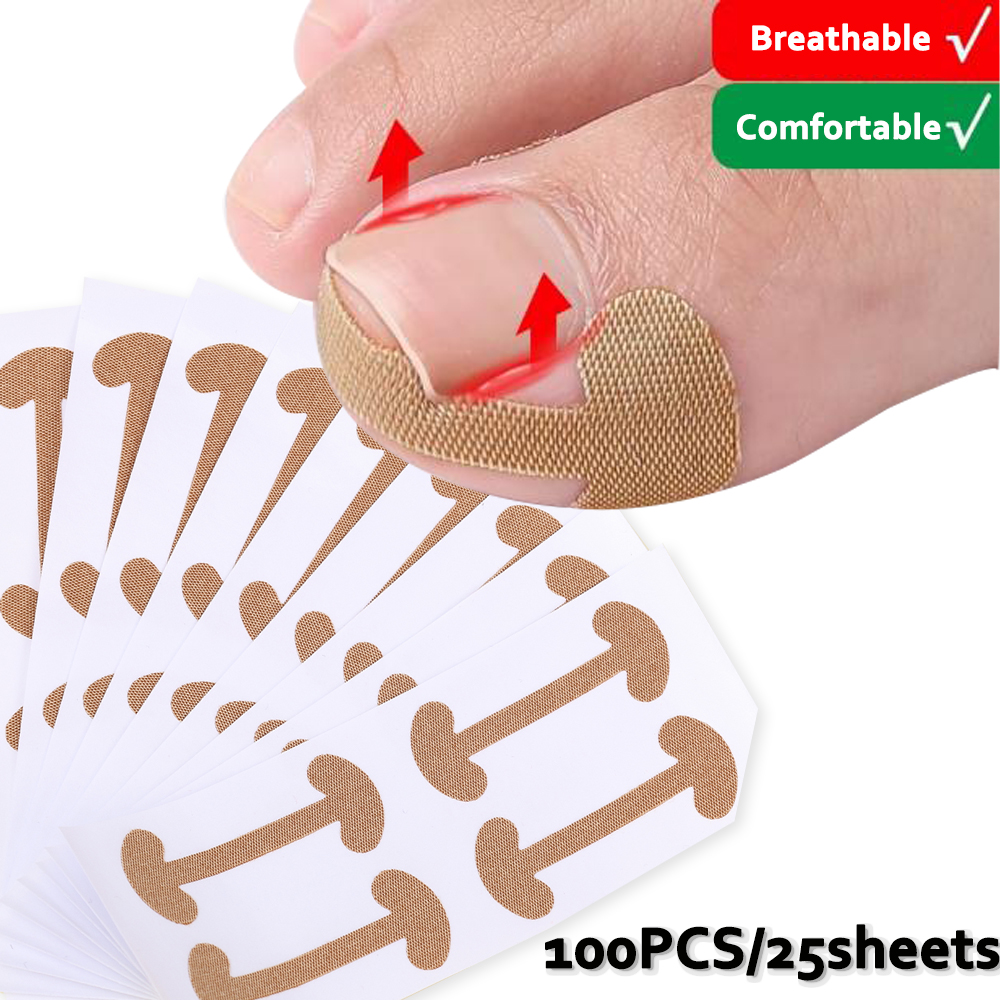 Ingrown Toenail Correction Strips for Fast Relief | Inspire Uplift