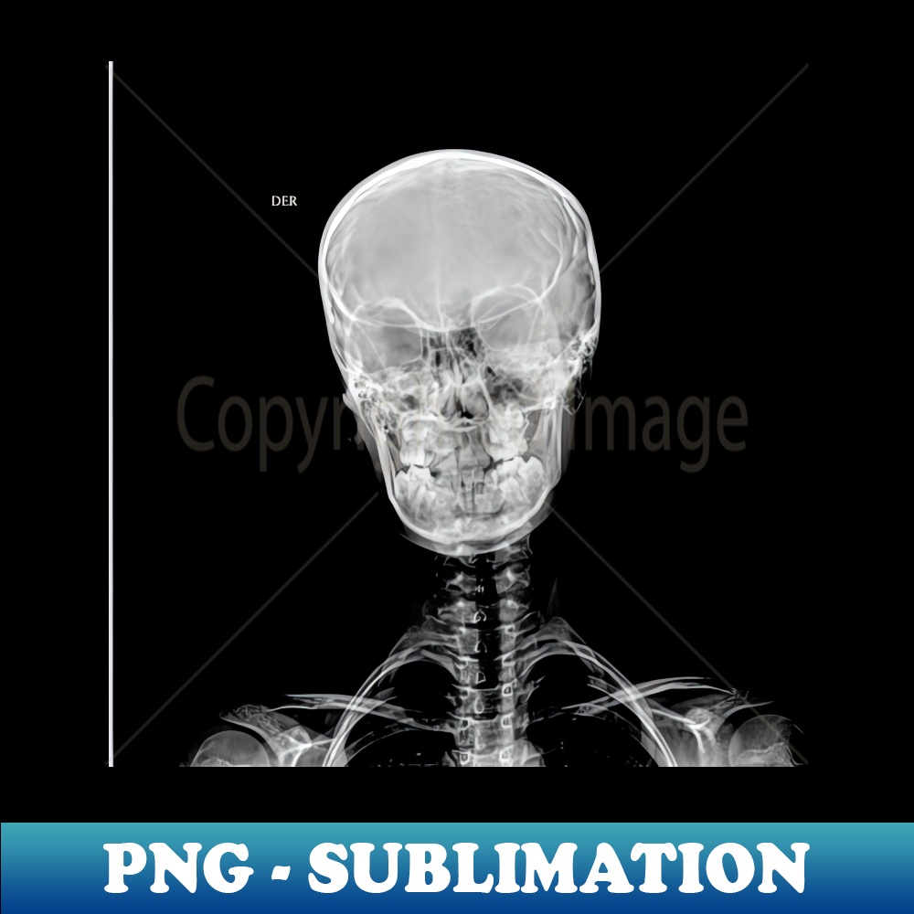Skull X- Ray - Retro PNG Sublimation Digital Download - Add - Inspire ...