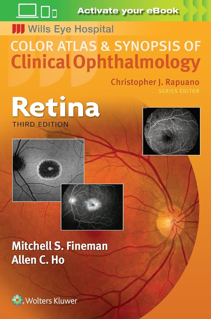Retina (Color Atlas and Synopsis of Clinical Ophthalmology) | Inspire ...