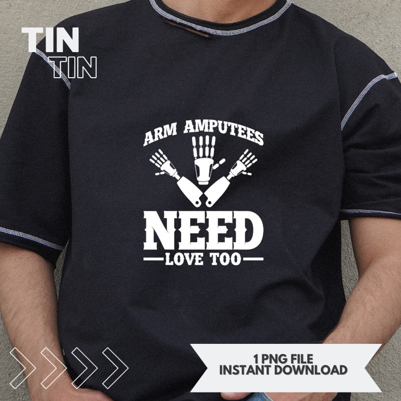 Arm Ampus Need Love Too Amputated Disable Prosthetic Arm | Inspire Uplift