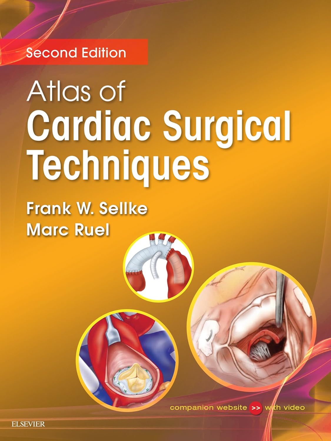 Atlas of cardiac surgical techniques 2nd Edition | Inspire Uplift