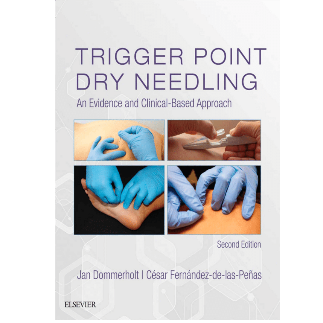 Trigger Point Dry Needling: An Evidence and Clinical-Based A | Inspire ...