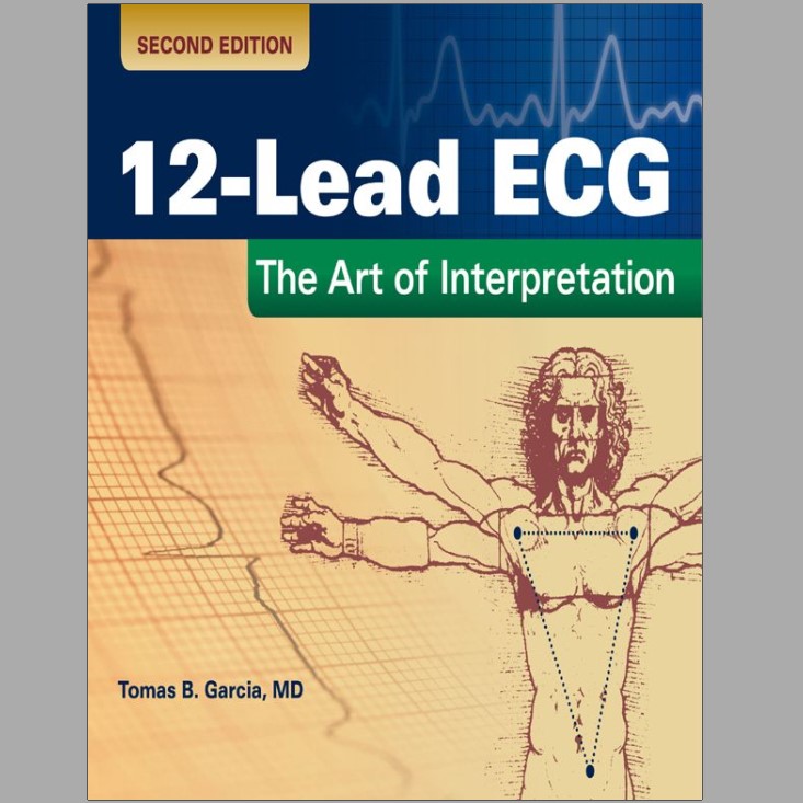 12-Lead ECG: The Art of Interpretation: The Art of Interpret - Inspire ...