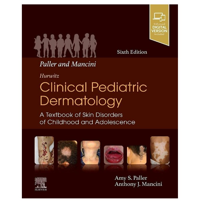 Hurwitz Clinical Pediatric Dermatology: A Textbook of Skin D | Inspire ...