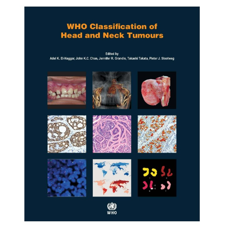 WHO Classification of Head and Neck Tumours (WHO Classificat - Inspire ...