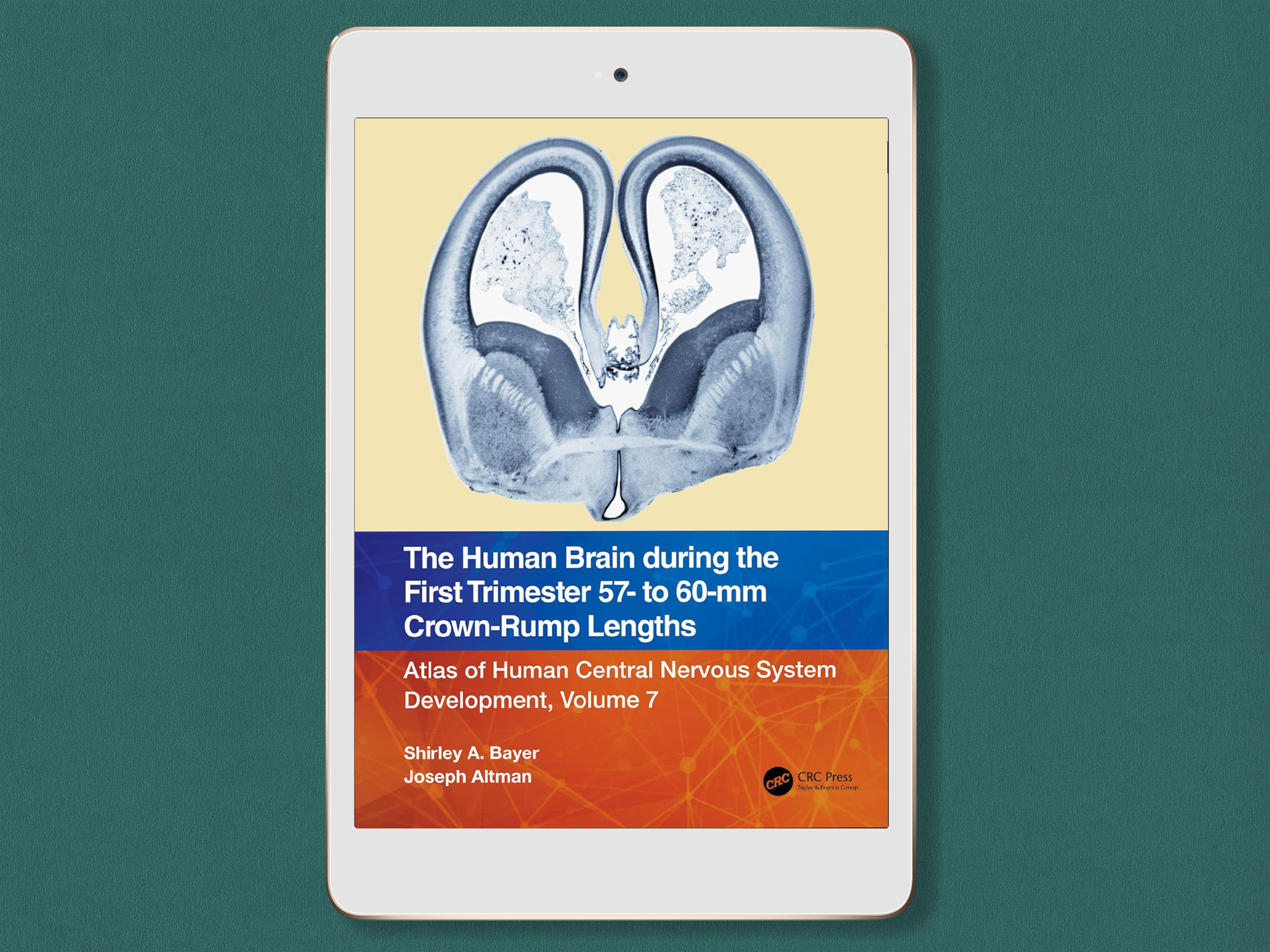 The Human Brain during the First Trimester 57- to 60-mm | Inspire Uplift