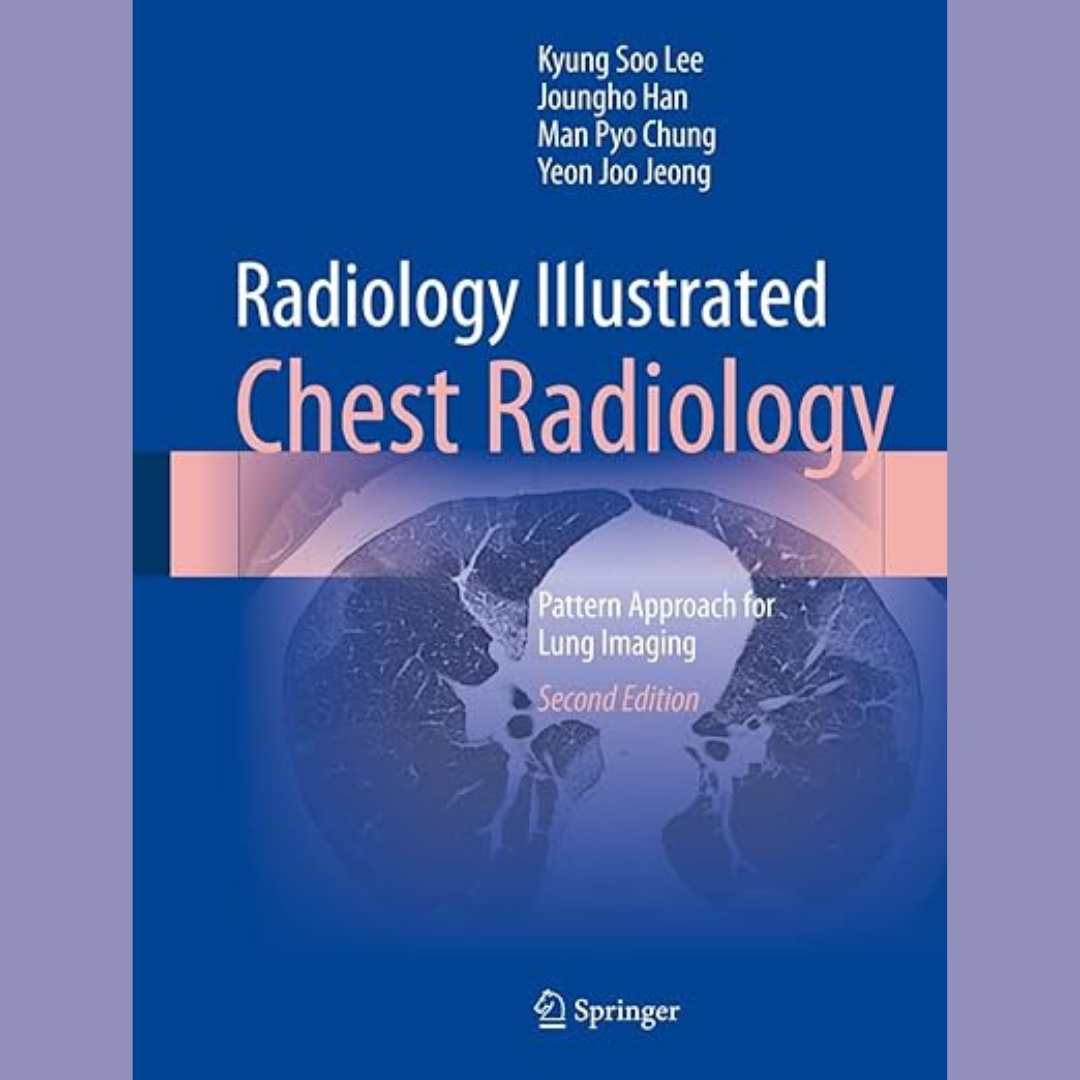 Radiology Illustrated. Chest Radiology. Pattern Approach for | Inspire ...