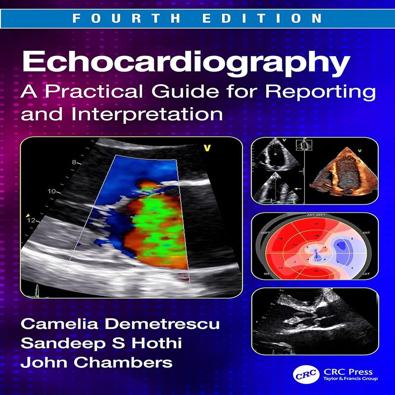 Echocardiography: A Practical Guide for Reporting and Interp | Inspire Uplift