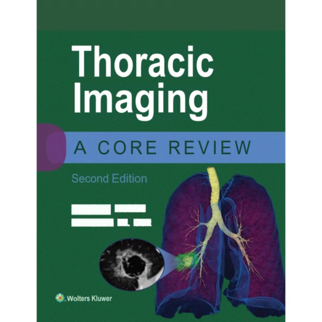Thoracic Imaging: A Core Review 2nd Edition | Inspire Uplift