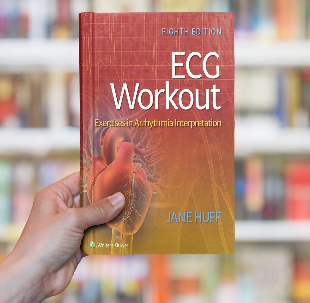 ECG Workout Exercises in Arrhythmia Interpretation Jane Huff | Inspire ...