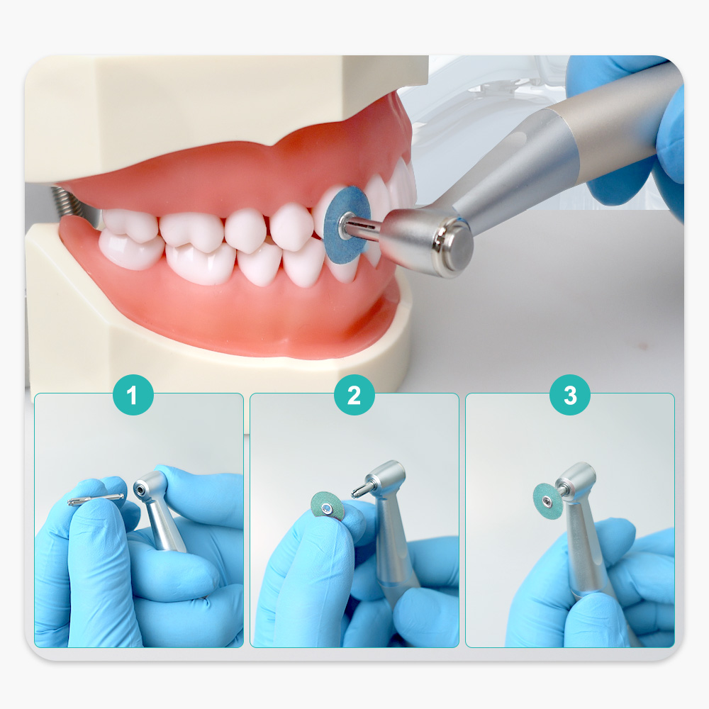Dental Polishing Discs for Restorations | Inspire Uplift