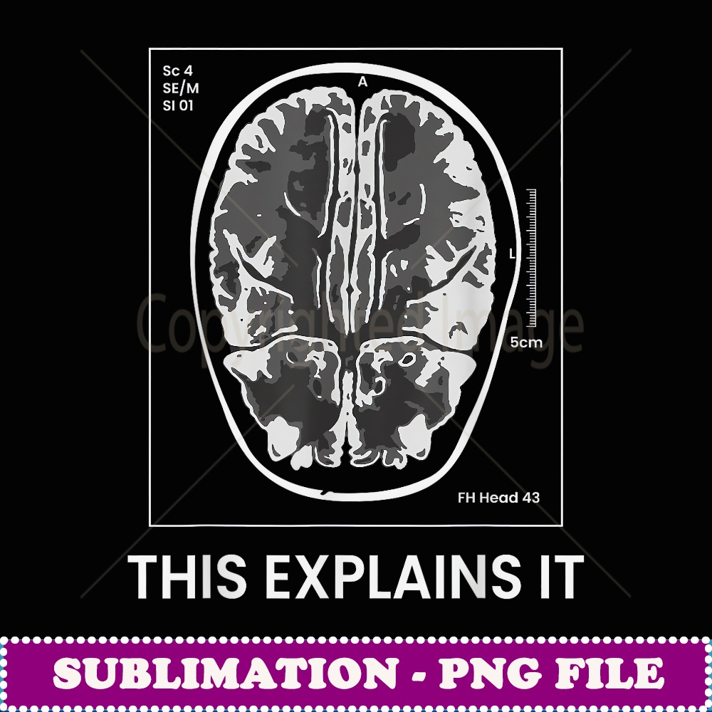 Funny MRI Scan B for CRAZY CAT LADY This Explains i - | Inspire Uplift