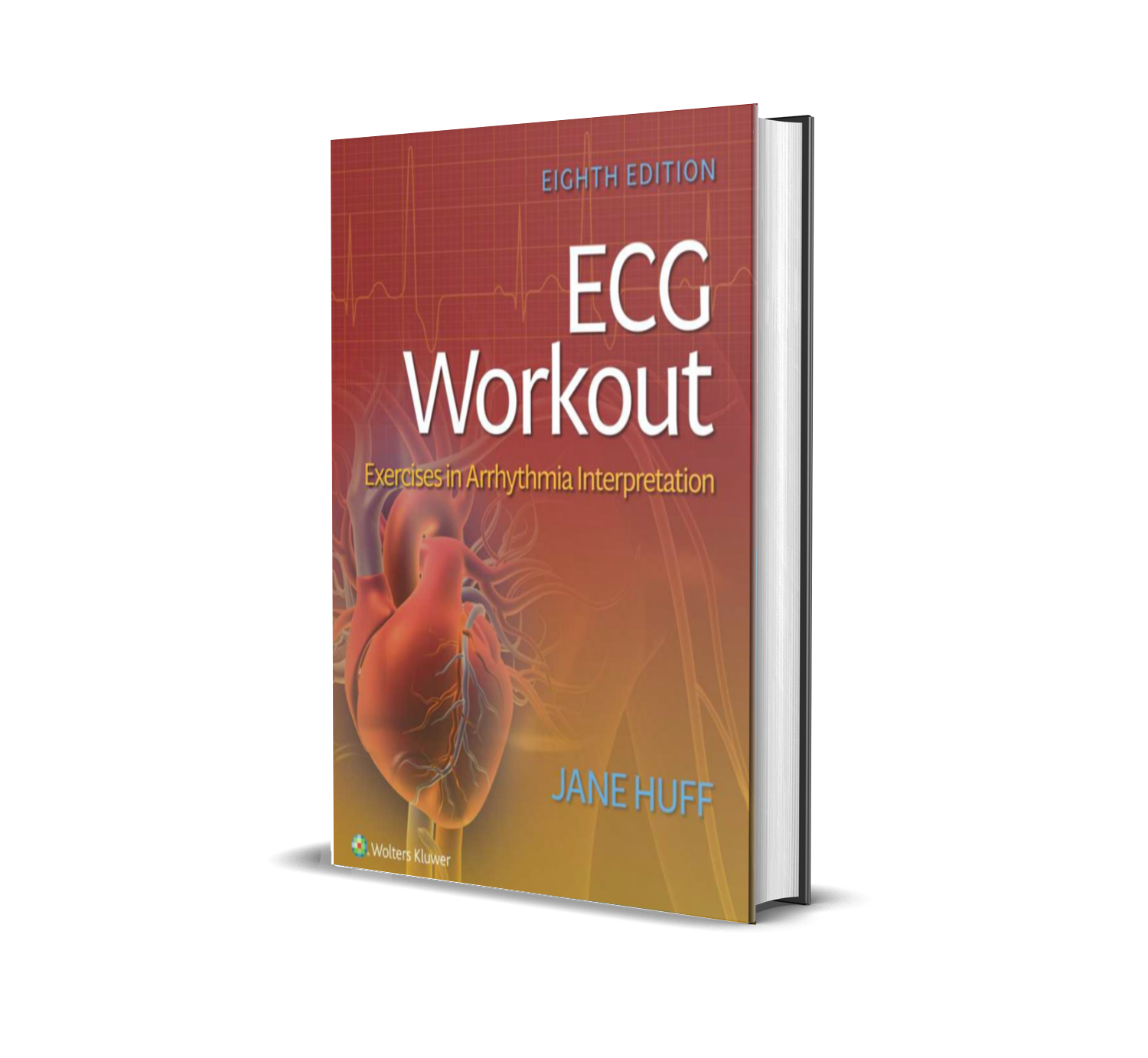 ECG Workout-Exercises in Arrhythmia Interpretation 8 edition | Inspire ...