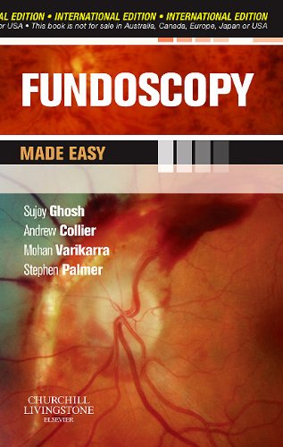 Fundoscopy made easy PDF instant Download | Inspire Uplift