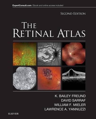 The Retinal Atlas, 2e 2 PDF Instant Download | Inspire Uplift