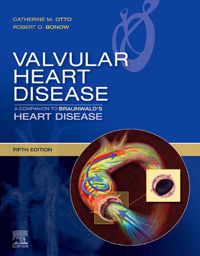 Valvular Heart Disease: A Companion to Braunwald's Heart Dis | Inspire ...