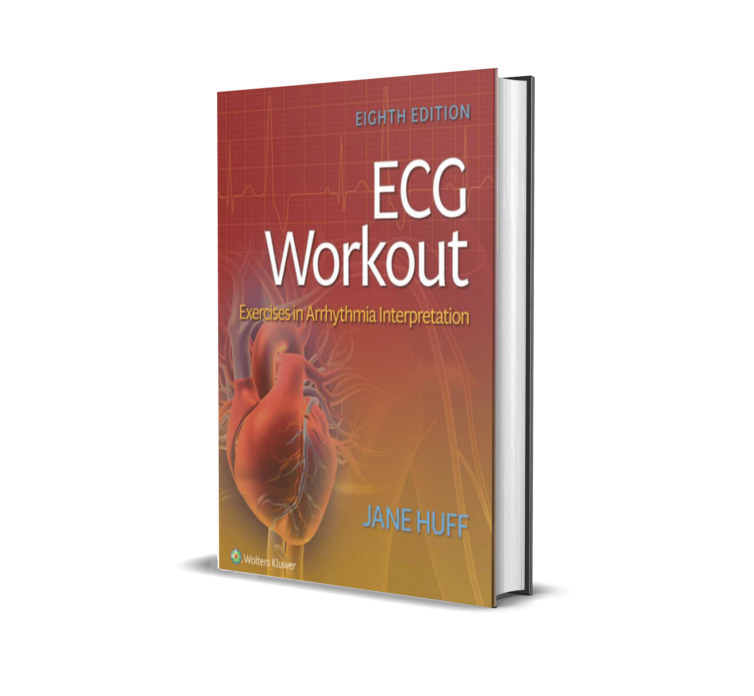 ECG Workout Exercises in Arrhythmia Interpretation 8 edition | Inspire ...