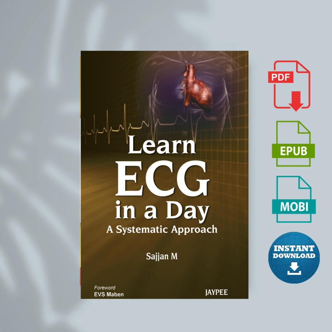 Learn ECG in a Day test | Inspire Uplift