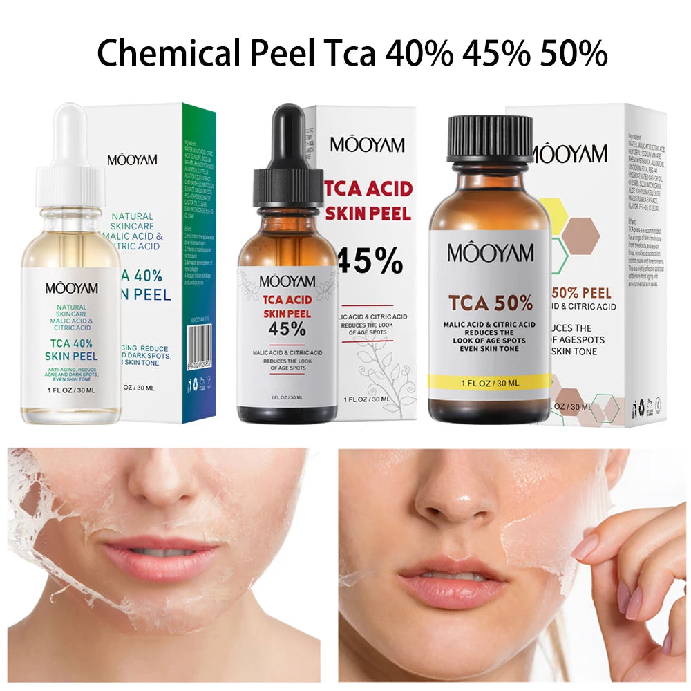 Chemical Peel Facial Peeling Serum | Inspire Uplift