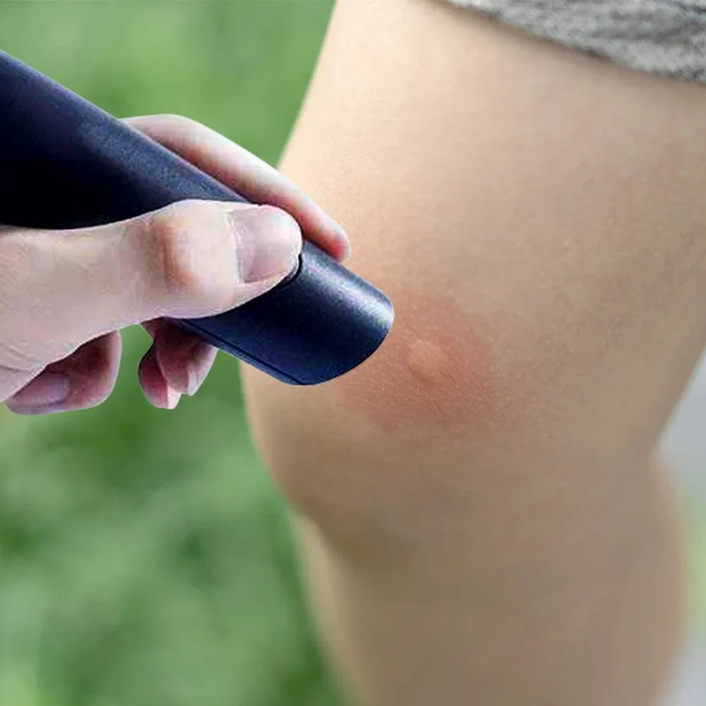 Electronic Mosquito Bite Pen – Fast Itch & Swelling Relief | Inspire Uplift
