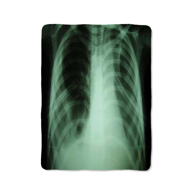 Chest X-Ray Design On Blanket | Inspire Uplift