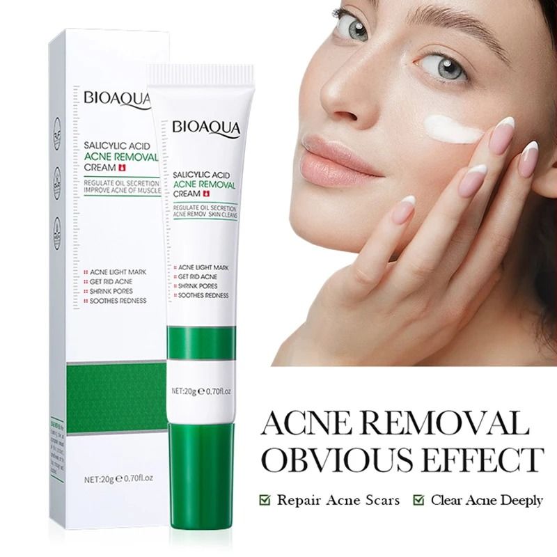 Salicylic Acid Face Cream for Acne Mark Repair and Blackhead | Inspire ...