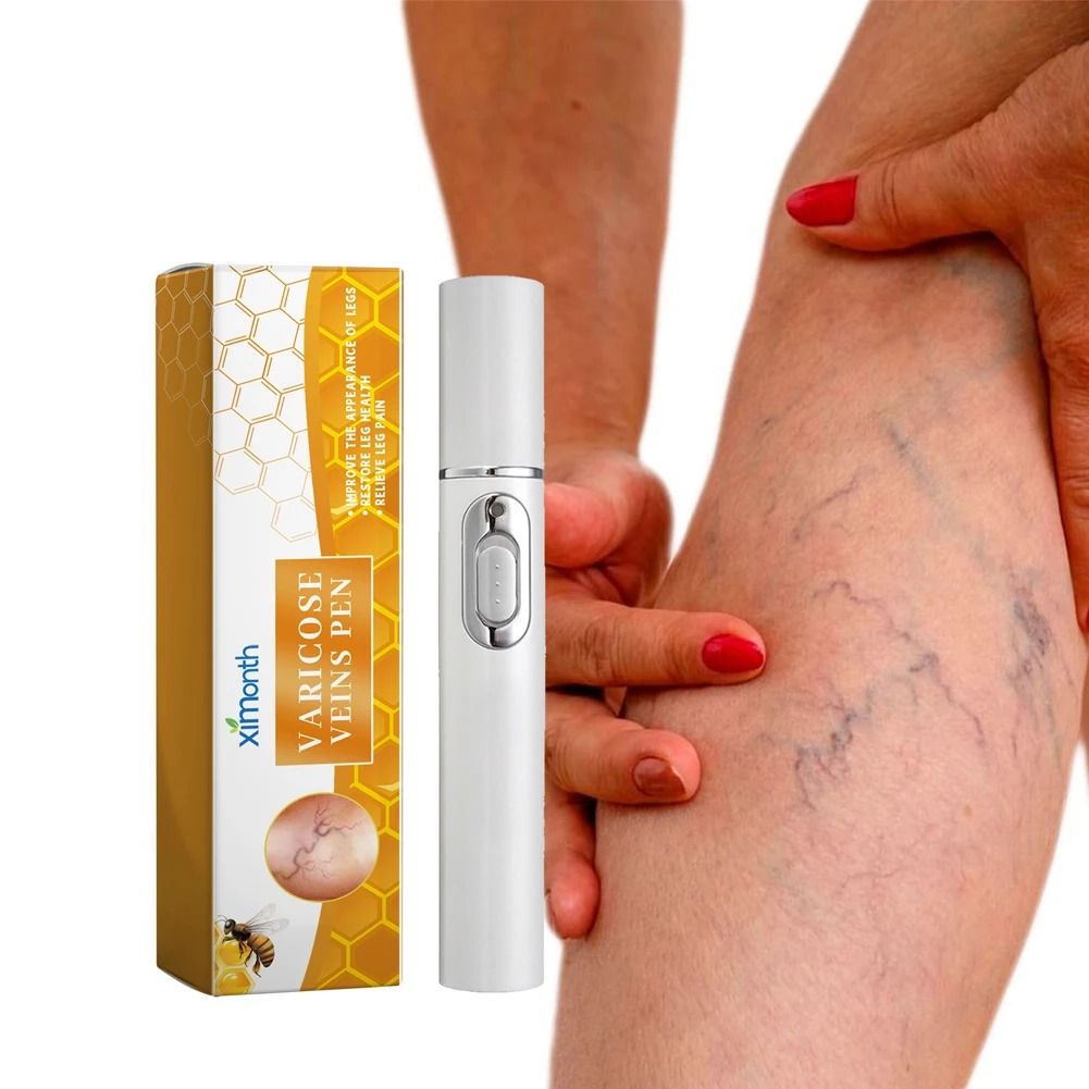 Varicose Vein Relief Pen for Soothing Leg Discomfort and Pro | Inspire ...