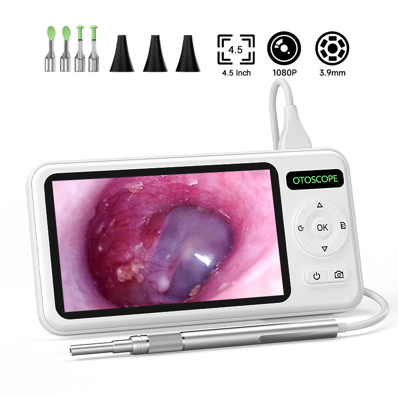 HD Digital Otoscope Ear Camera with 6 LEDs | Inspire Uplift